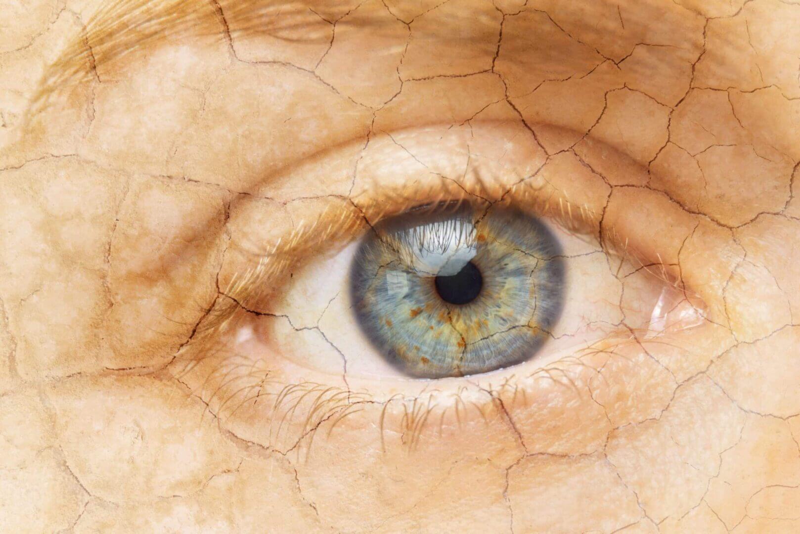 Eye Vision Signs That Could Indicate an Ischemic Attack: An Unmissable ...